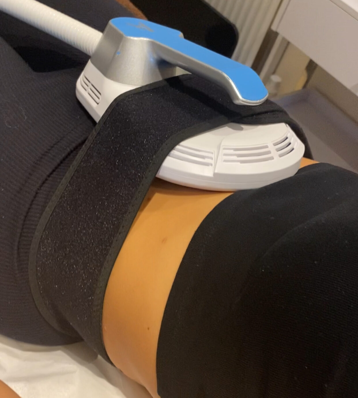 Body Contouring Services | Aesthetics Central