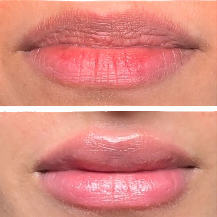 Skin & Tissues Boosters - Aesthetics Central Clinic