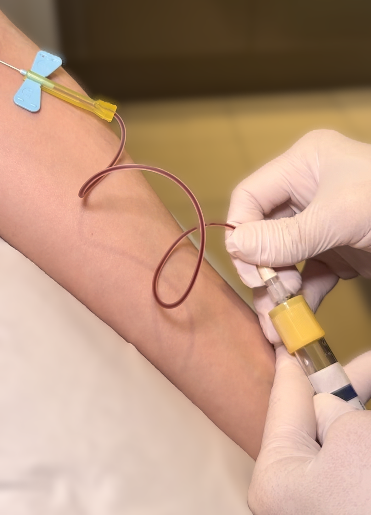 Blood Tests - Aesthetics Central Clinic